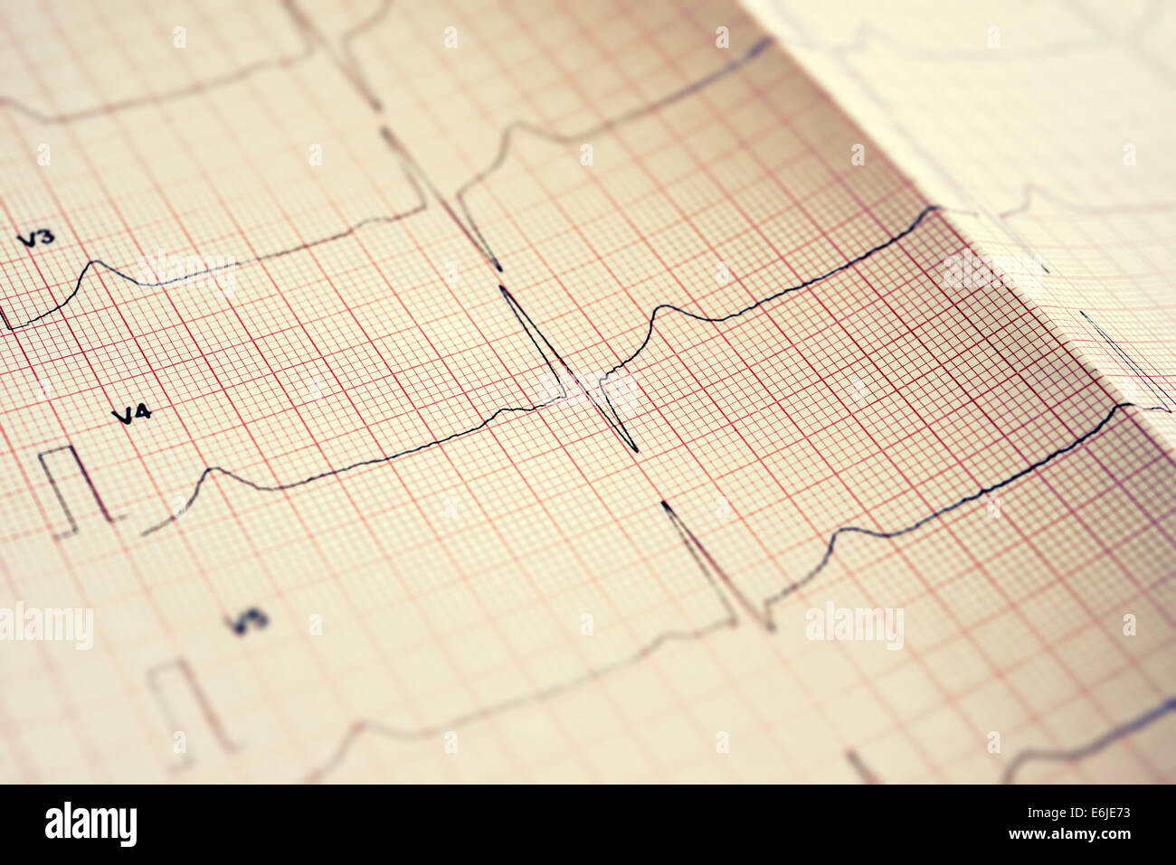 Elektro kardiogramm -Fotos und -Bildmaterial in hoher Auflösung – Alamy