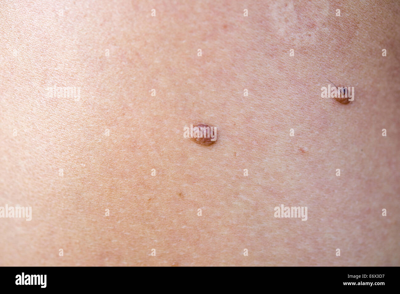 Zwei haut -Fotos und -Bildmaterial in hoher Auflösung – Alamy