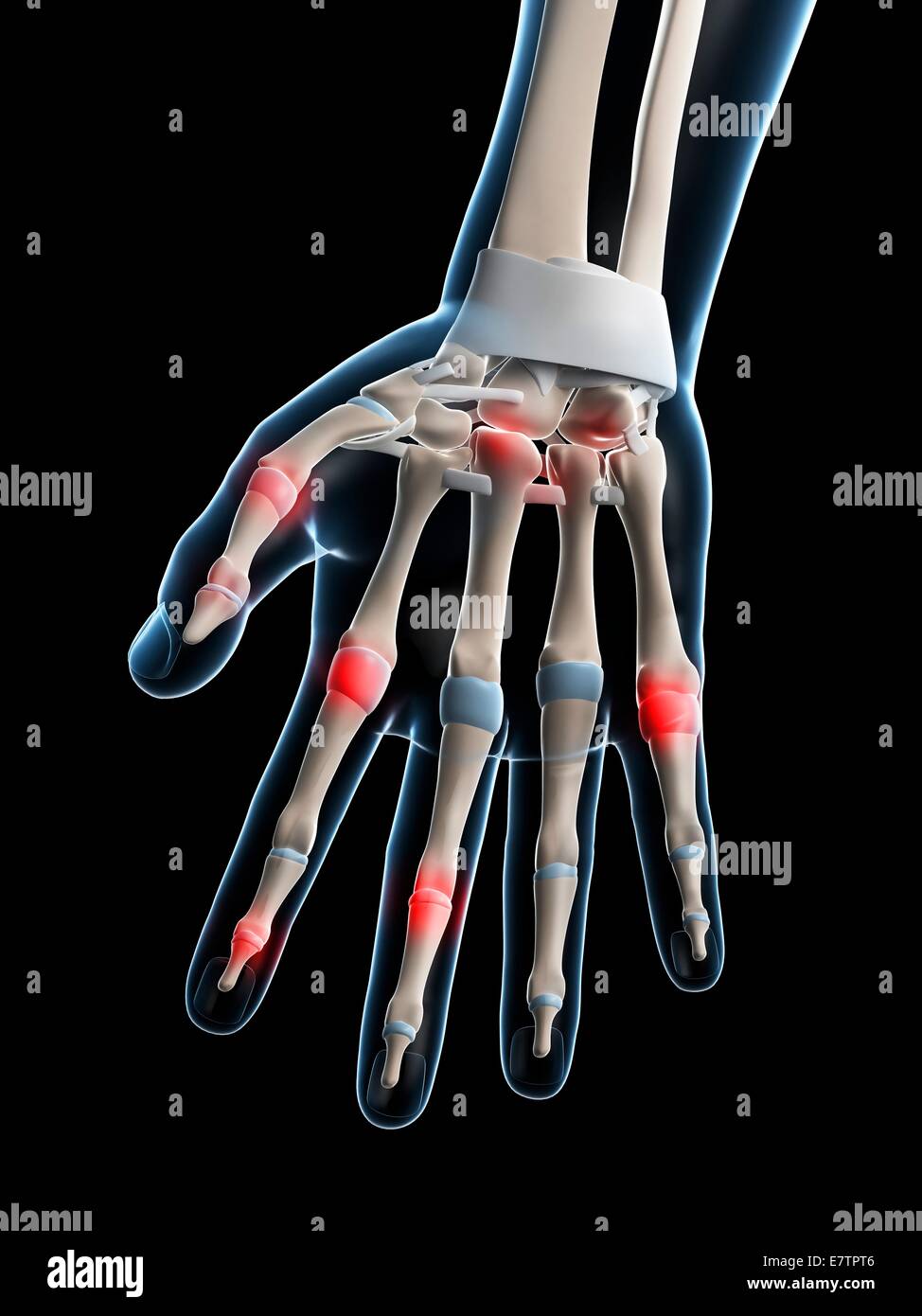 Menschlichen Fingergelenke, Computer-Grafik Stockfotografie - Alamy