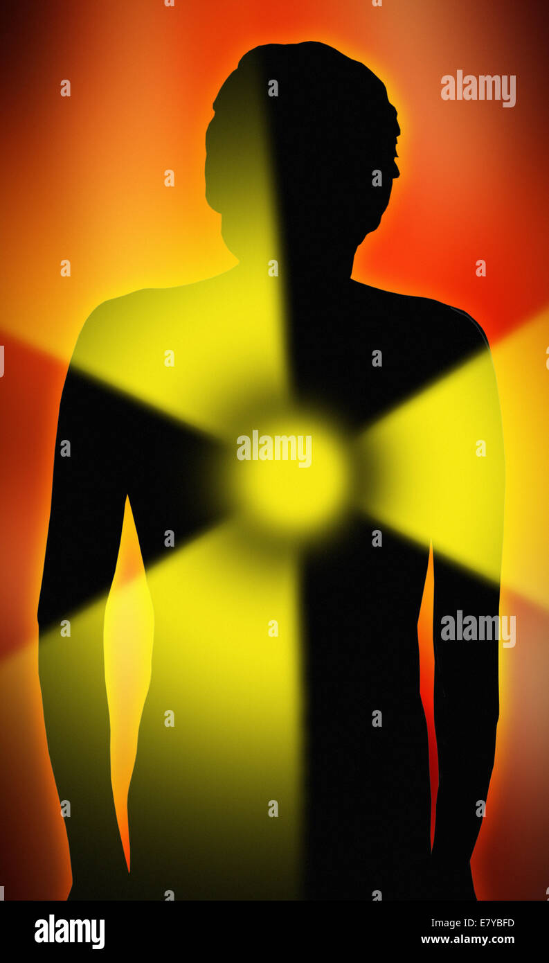 Strahlung tut -Fotos und -Bildmaterial in hoher Auflösung – Alamy
