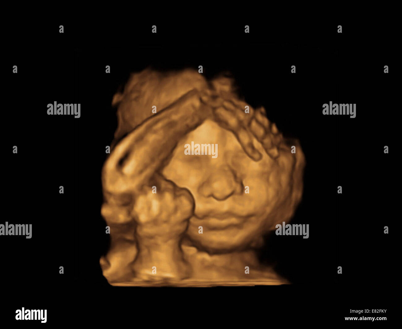 Fetus ultrasound 24 -Fotos und -Bildmaterial in hoher Auflösung – Alamy