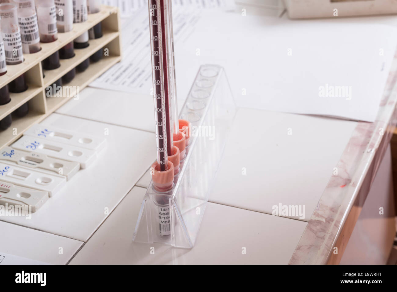 Blood analysis -Fotos und -Bildmaterial in hoher Auflösung – Alamy