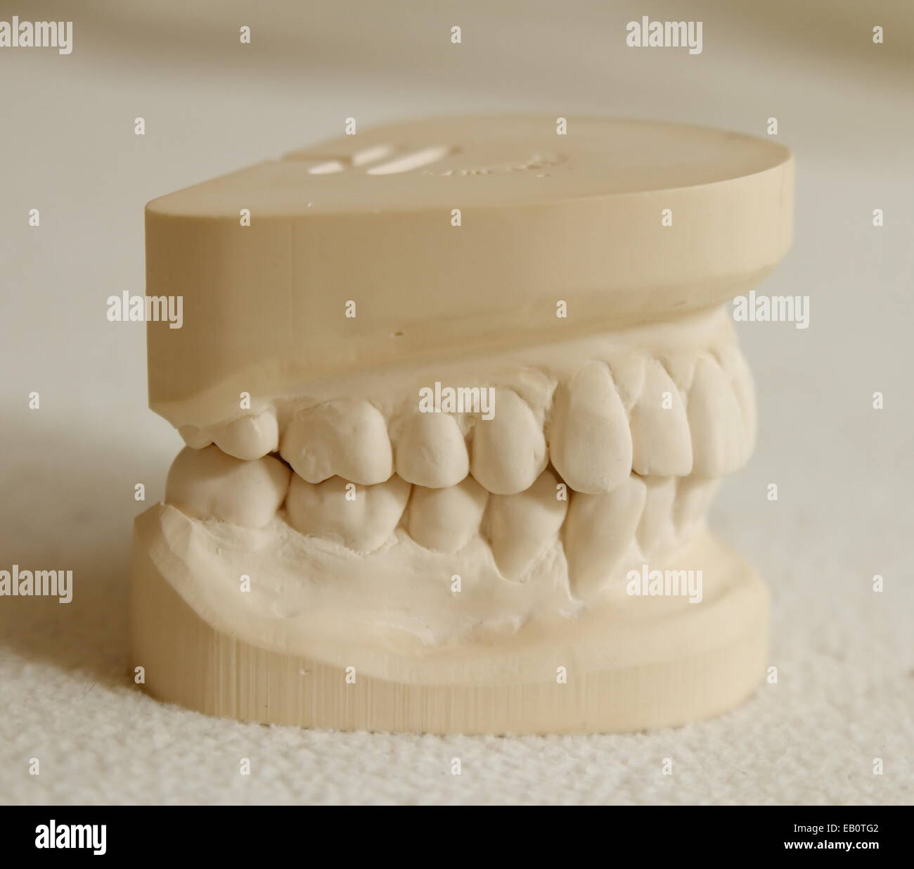 Dental Gips Modell Form der Zähne in Gips Stockfotografie - Alamy