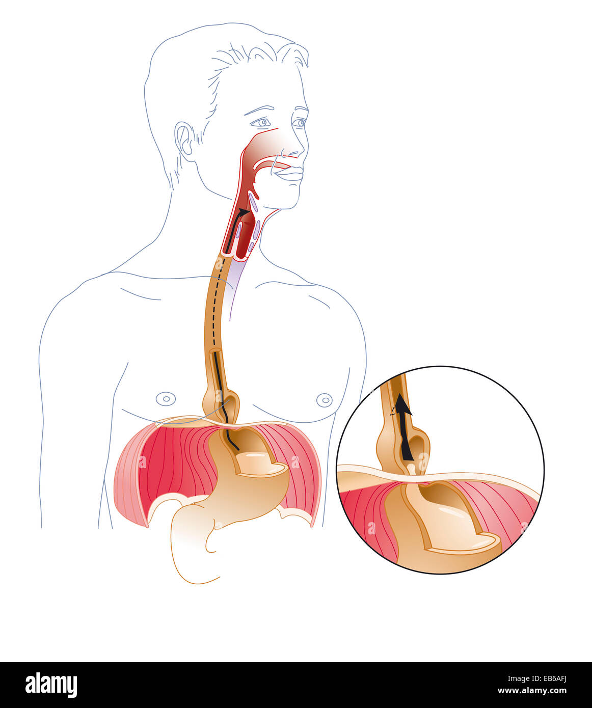 Hiatal hernias -Fotos und -Bildmaterial in hoher Auflösung – Alamy