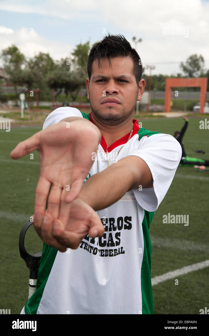 Beide arm amputiert -Fotos und -Bildmaterial in hoher Auflösung – Alamy