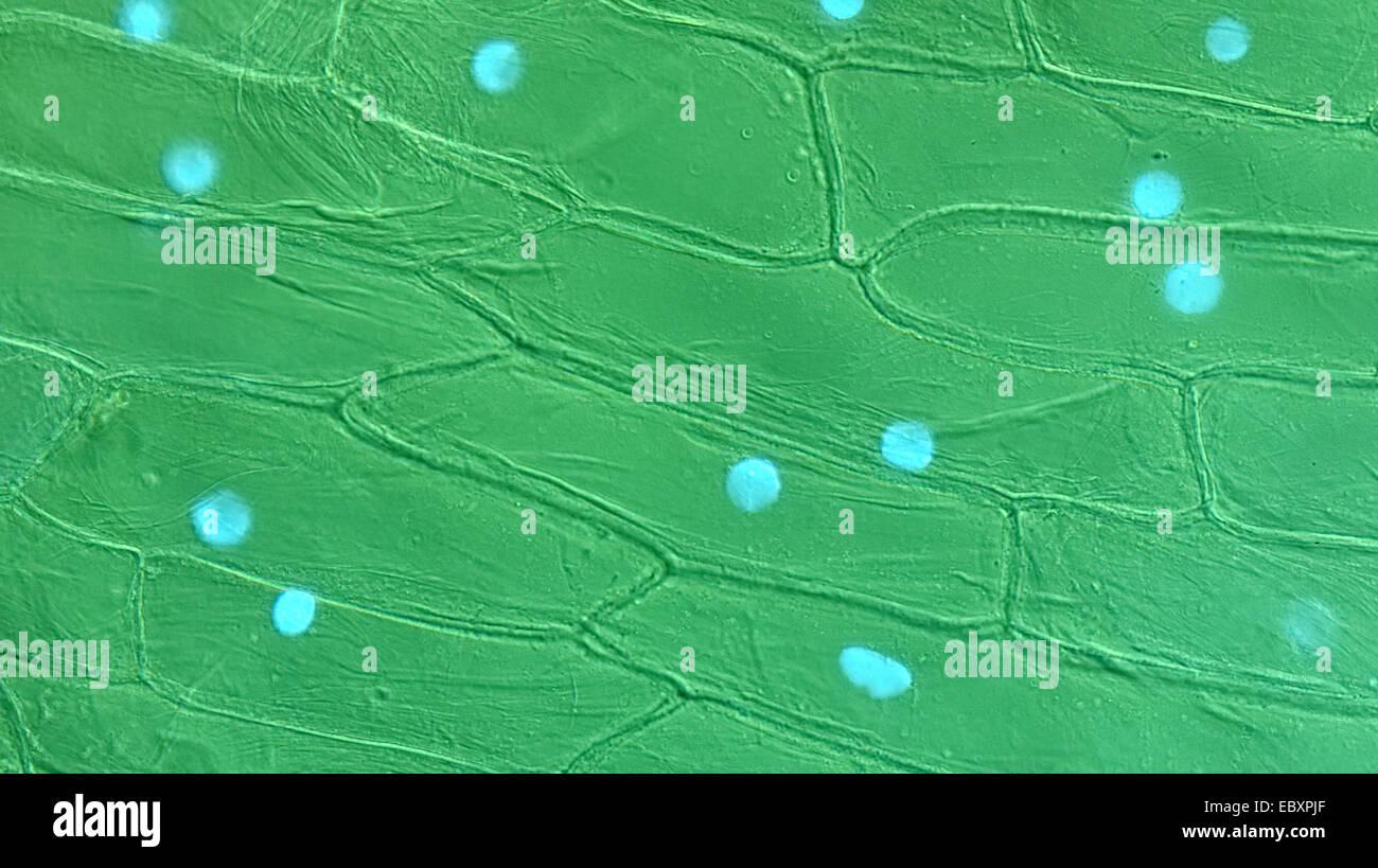 Zellwände und Organellen der Zwiebel skalieren Epidermiszellen ...