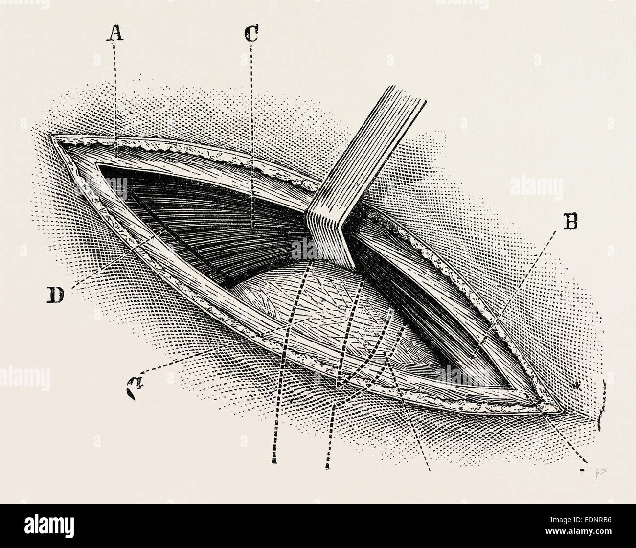 Rechts iliac -Fotos und -Bildmaterial in hoher Auflösung – Alamy