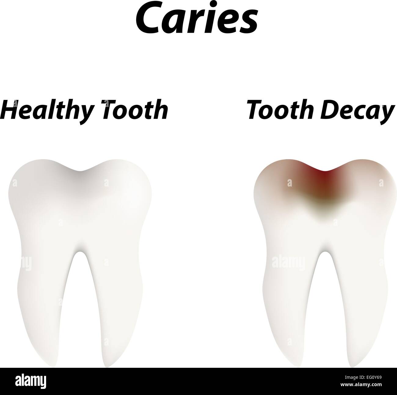 Karies karies Stock-Vektorgrafiken kaufen - Alamy