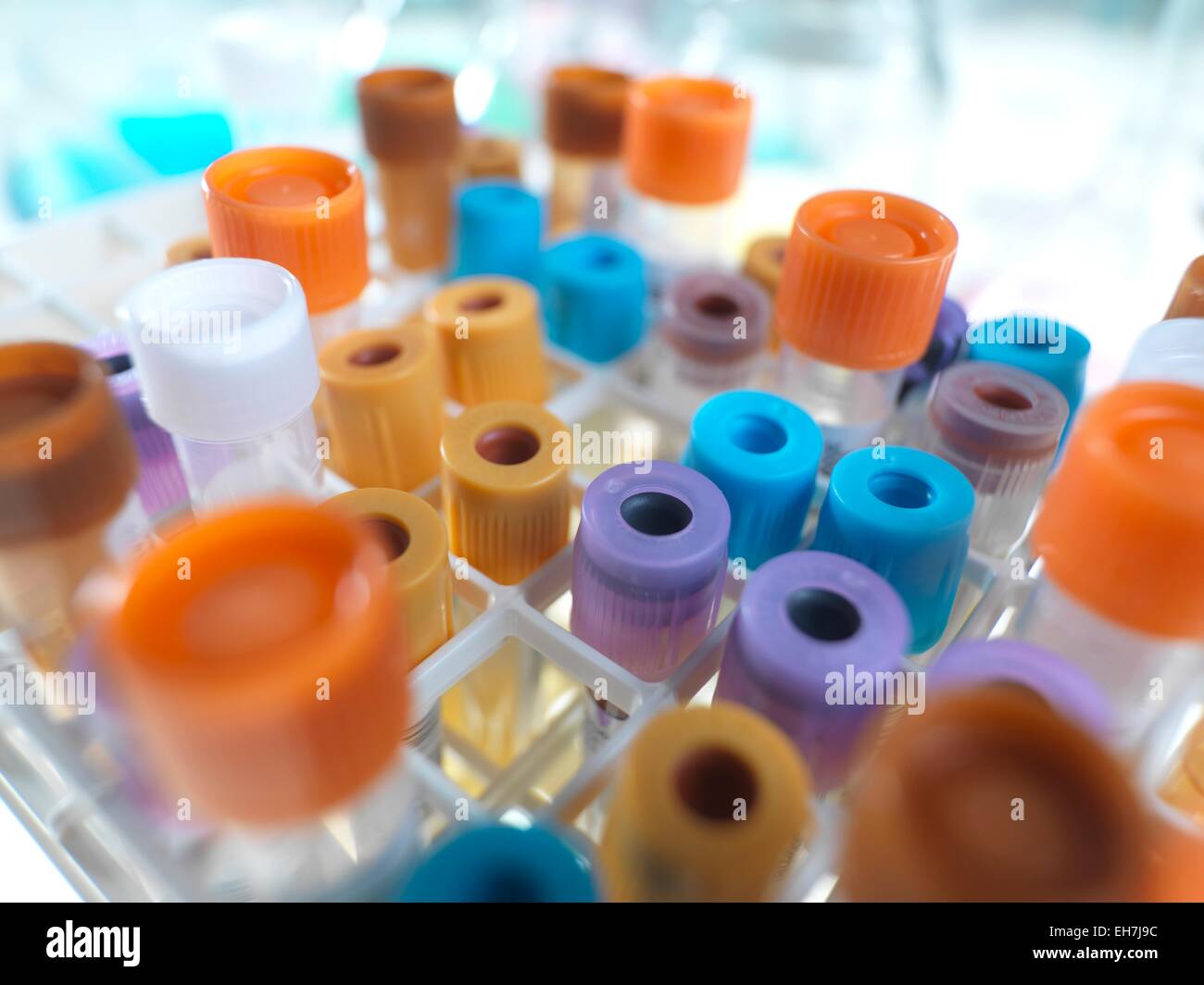 Medical samples -Fotos und -Bildmaterial in hoher Auflösung – Alamy