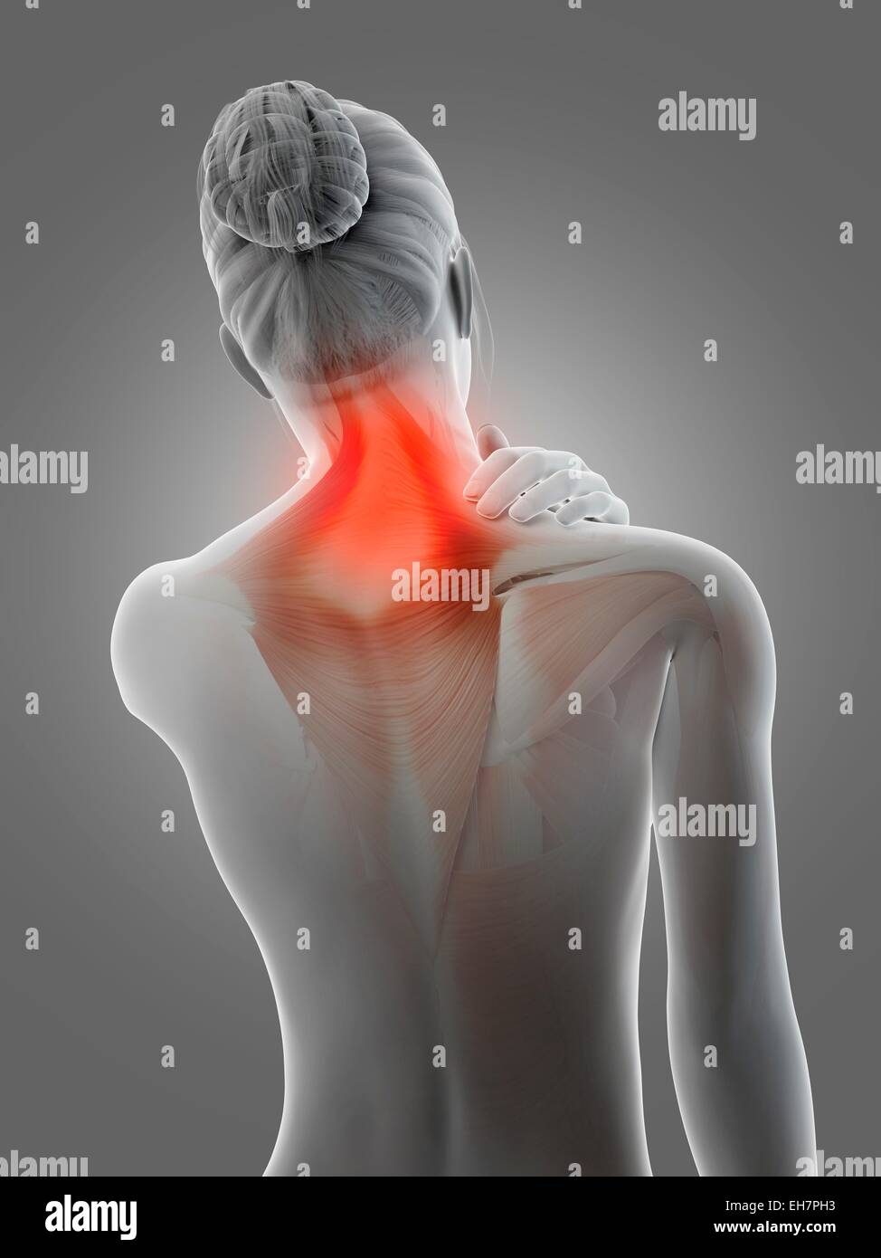 Menschlichen Nackenmuskulatur, Abbildung Stockfotografie - Alamy