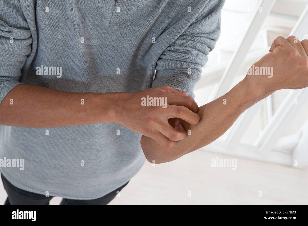 Itching arm -Fotos und -Bildmaterial in hoher Auflösung – Alamy