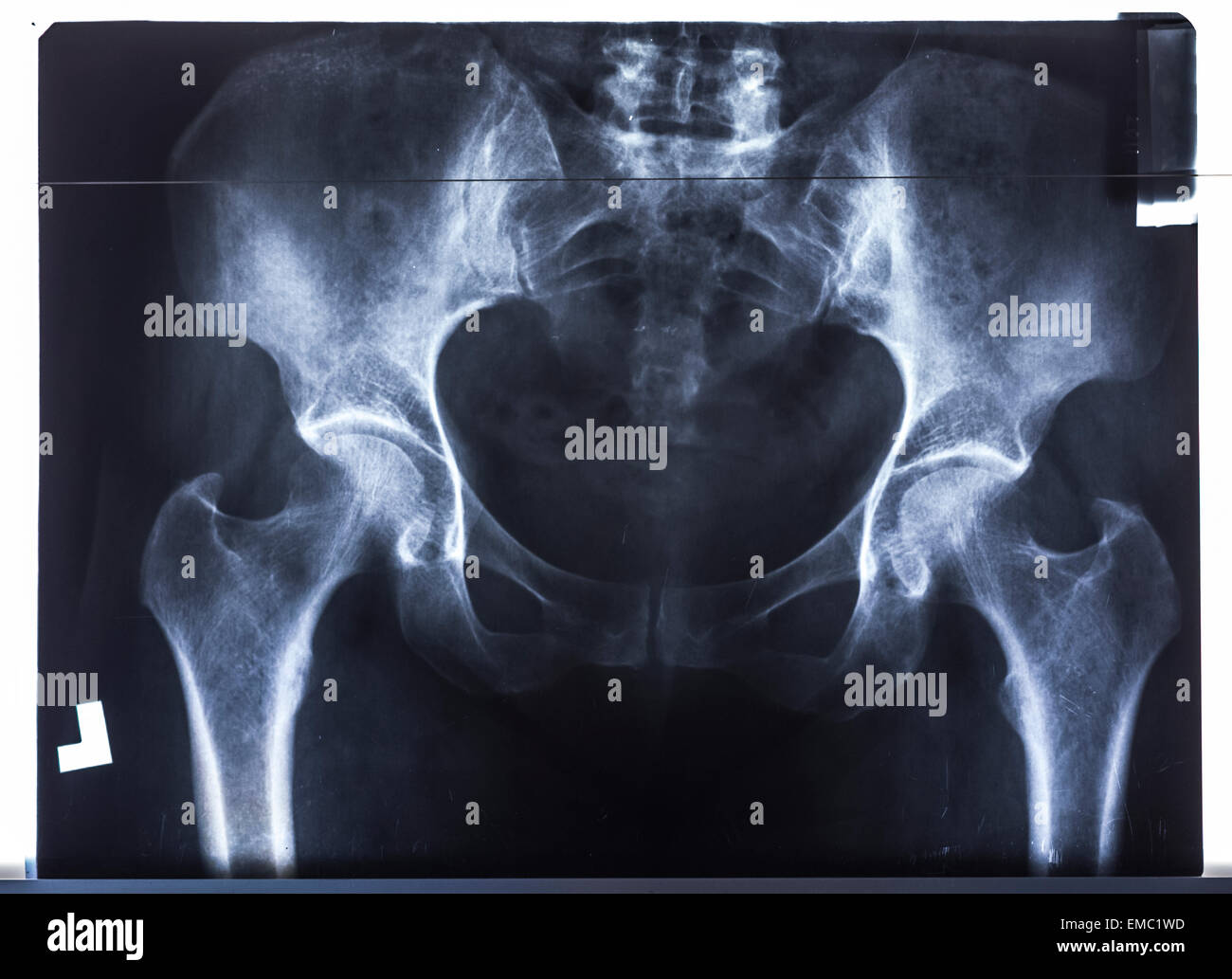 Pelvic Examination Stockfotos & Pelvic Examination Bilder - Alamy