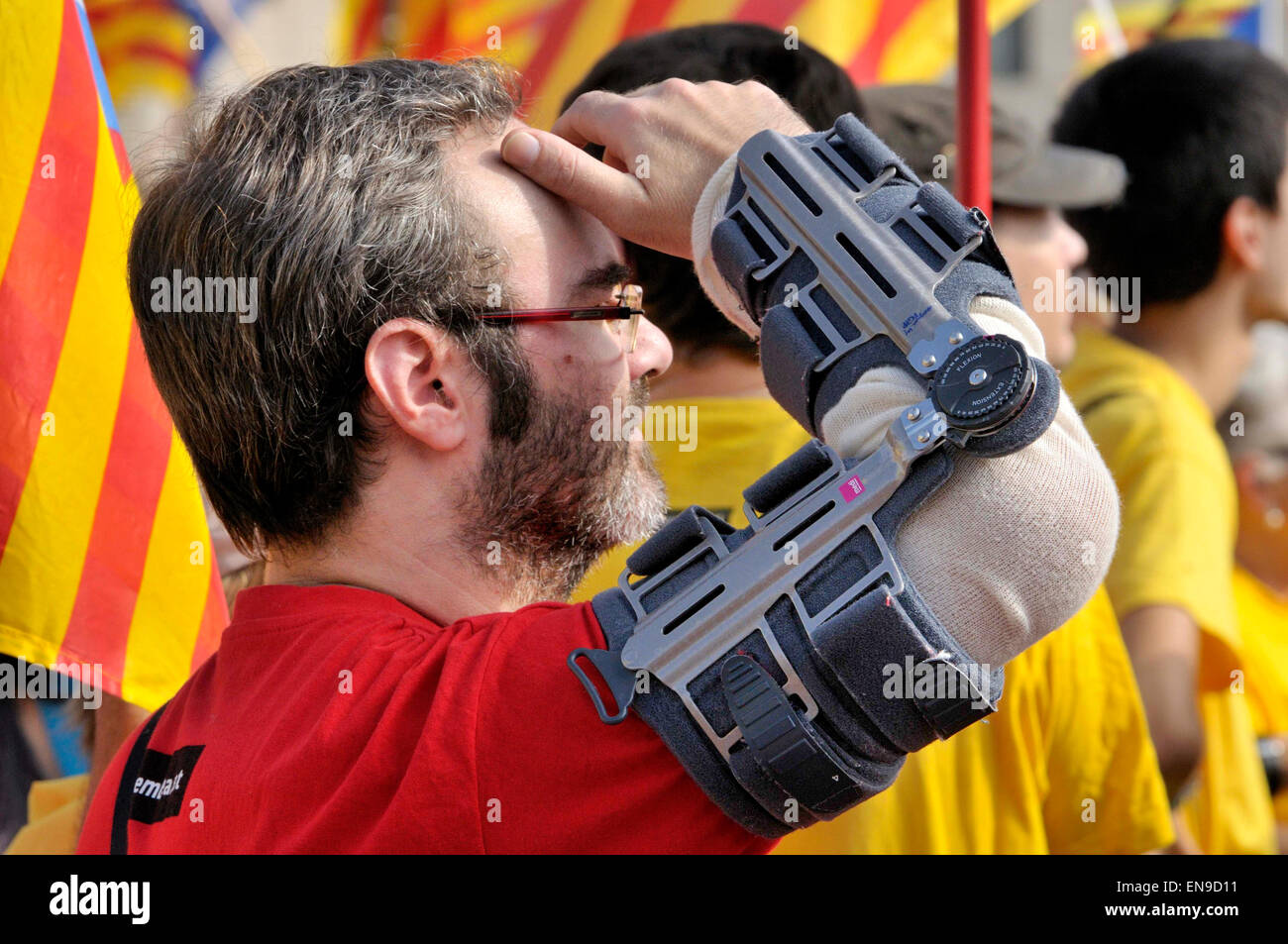 Orthose, externes Gerät verändern die strukturellen und funktionellen ...