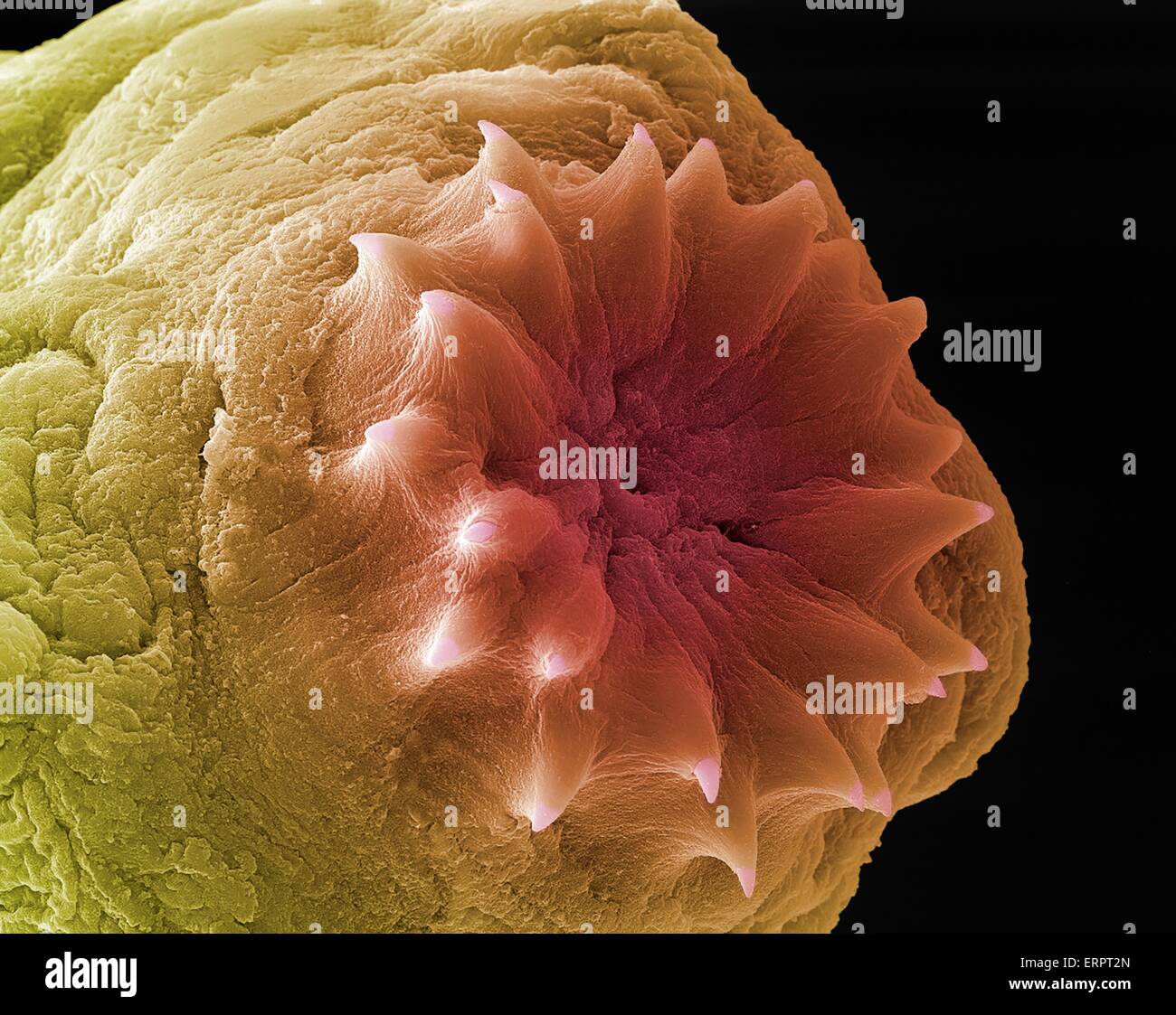 Bandwurm Hundekopf. Farbige scanning Electron Schliffbild (SEM) der ...