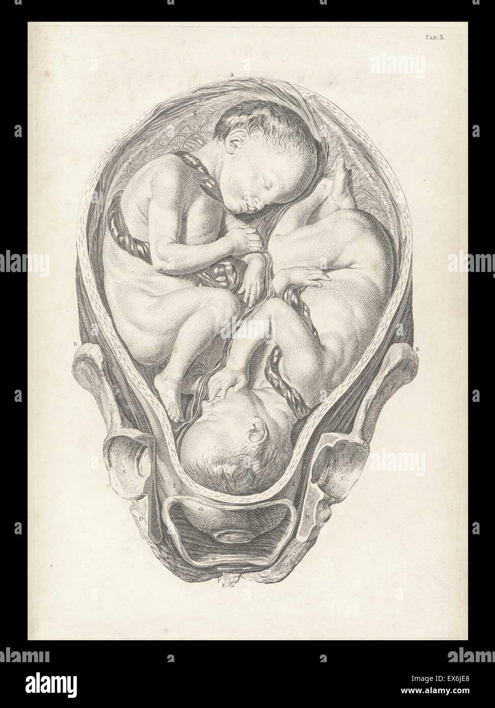 Einstellung von anatomischen tabellen -Fotos und -Bildmaterial in hoher ...