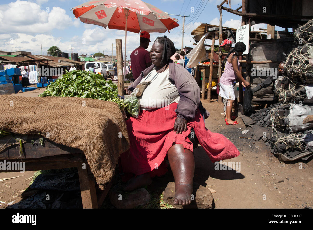 African obesity -Fotos und -Bildmaterial in hoher Auflösung – Alamy