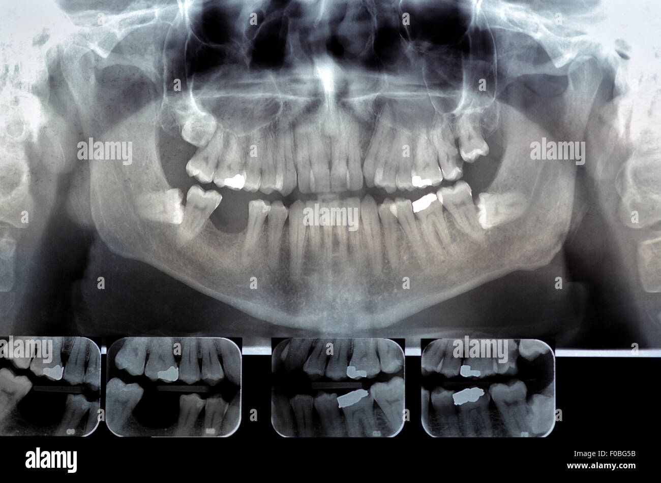Digitale Radiographie Stockfotos und -bilder Kaufen - Alamy