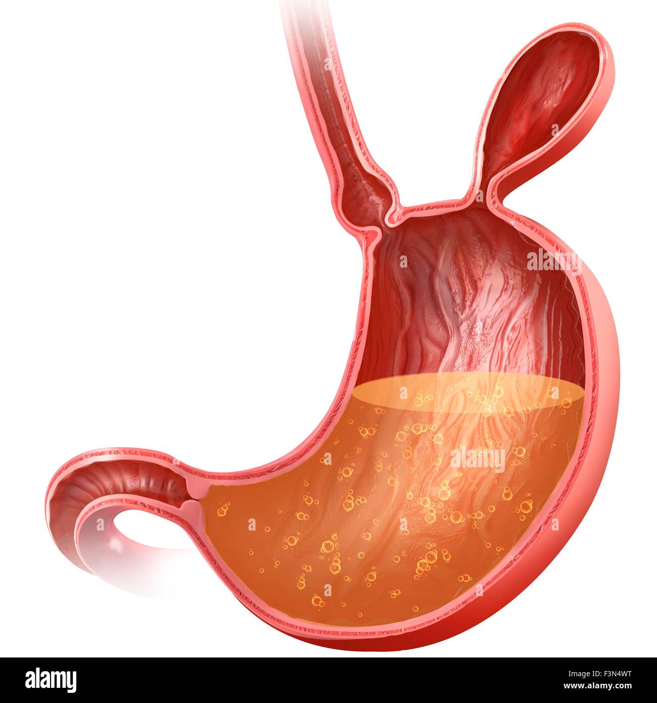 Magen mit Leistenbruch, Abbildung Stockfotografie - Alamy
