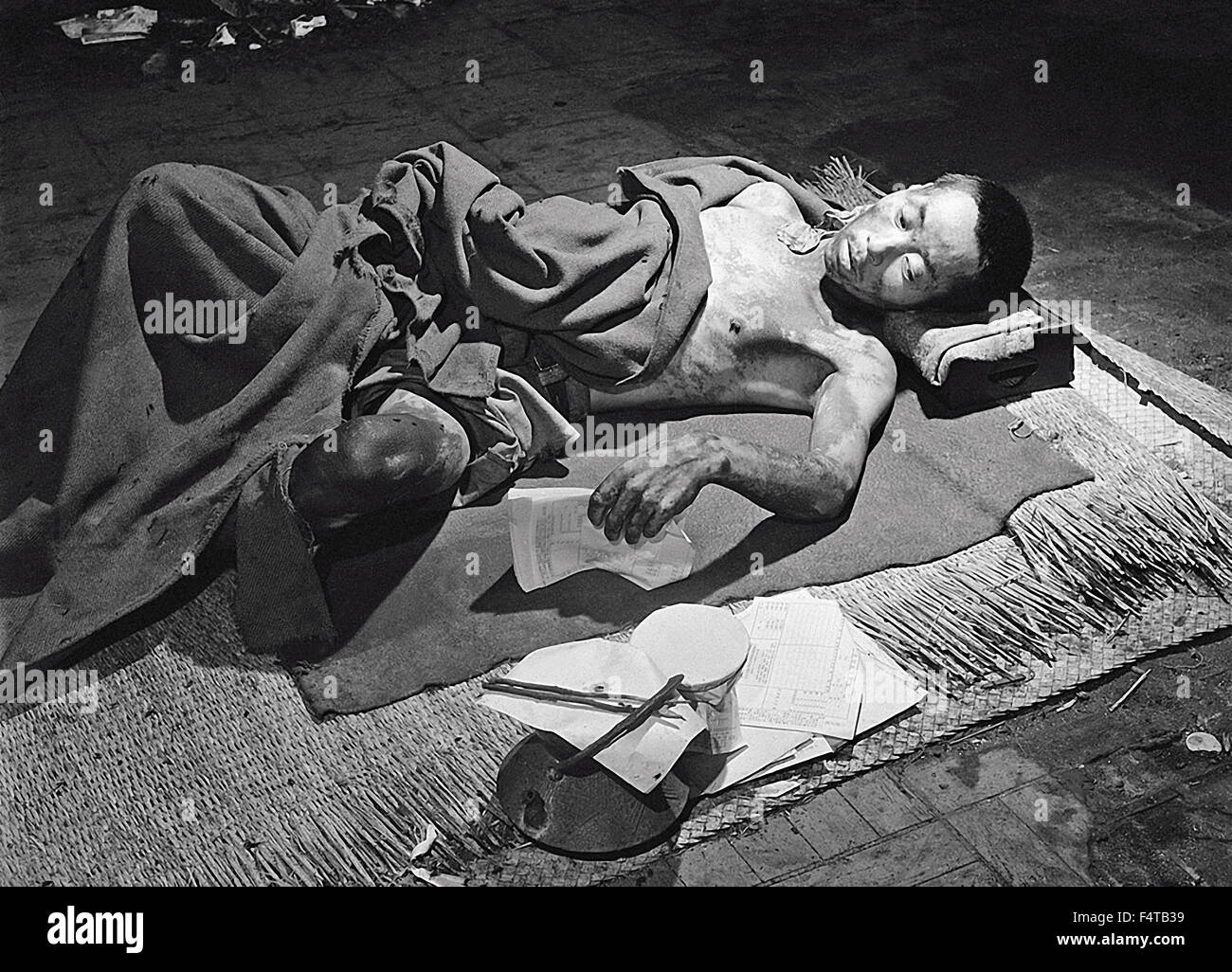 Victim of the atomic bomb -Fotos und -Bildmaterial in hoher Auflösung ...