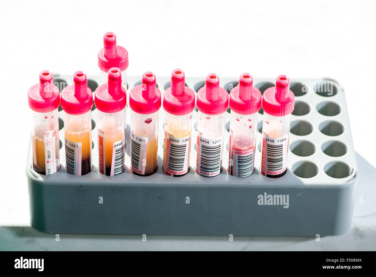 Blutserum röhrchen -Fotos und -Bildmaterial in hoher Auflösung – Alamy