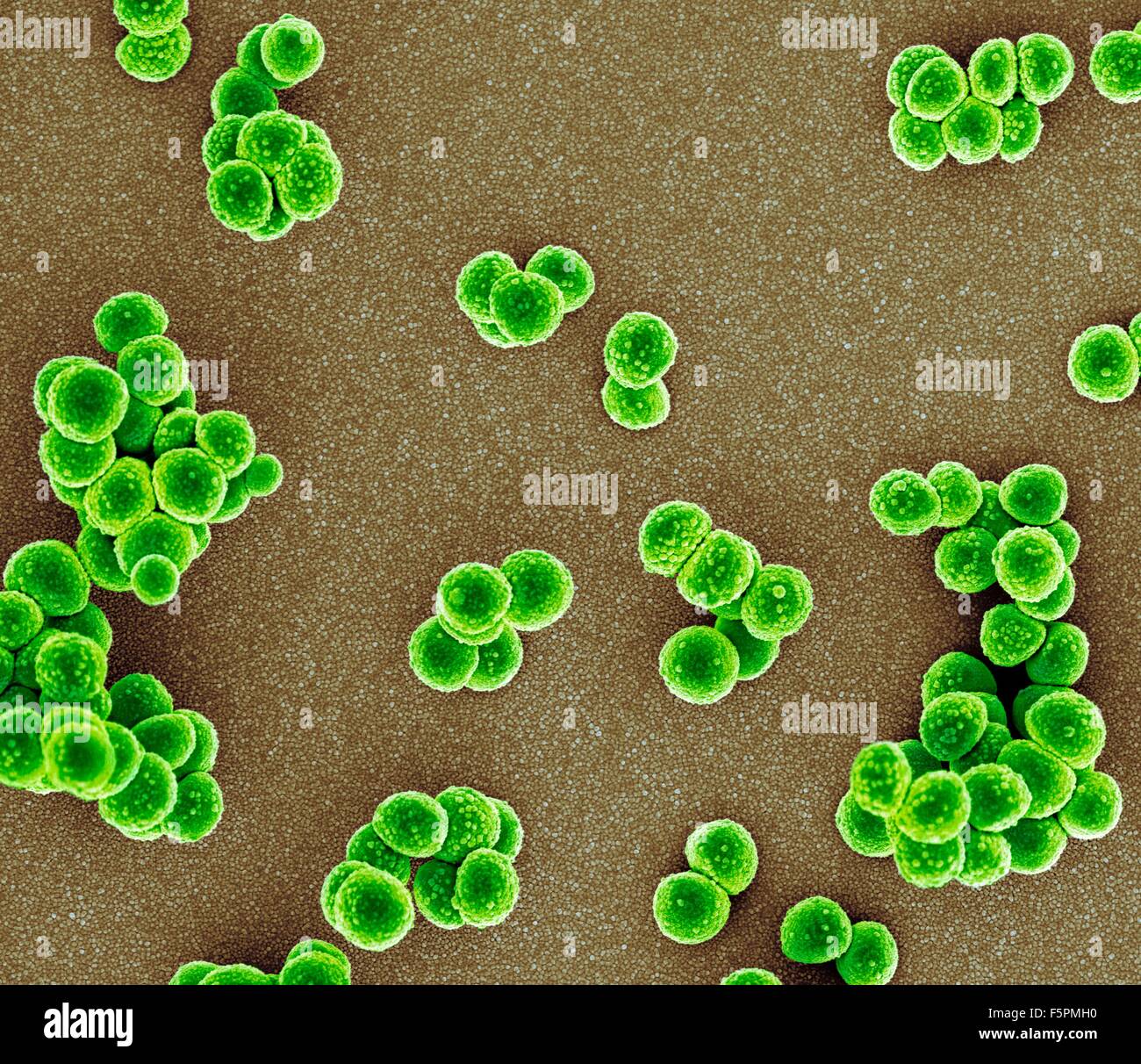 MRSA-Bakterien. Farbige scanning Electron Schliffbild (SEM) von ...