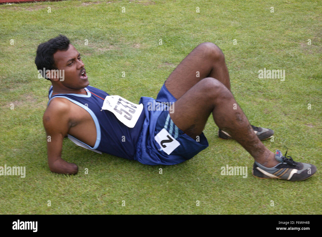 Recovering amputee -Fotos und -Bildmaterial in hoher Auflösung – Alamy
