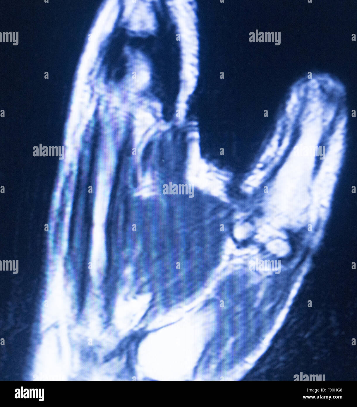 MRT Magnet-Resonanz-Tomographie medizinischen Test Scanergebnisse mit ...