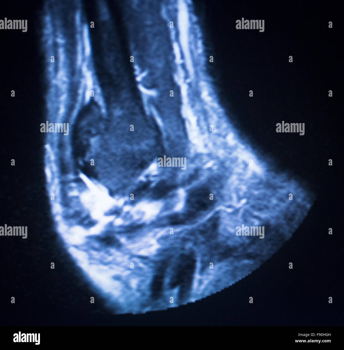 MRT Magnet-Resonanz-Tomographie medizinischen Test Scanergebnisse mit ...
