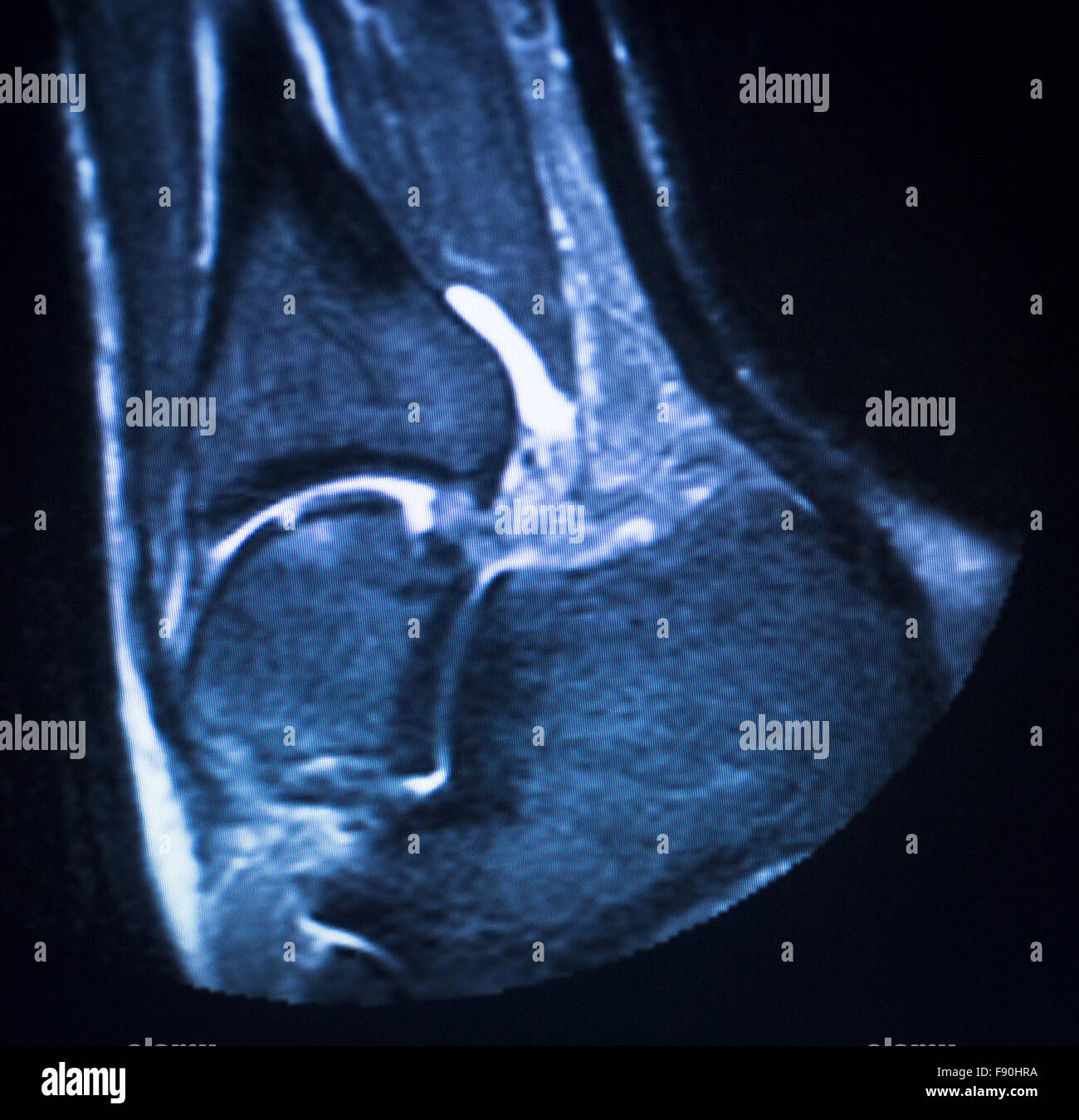 MRT Magnet-Resonanz-Tomographie medizinischen Test Scanergebnisse mit ...