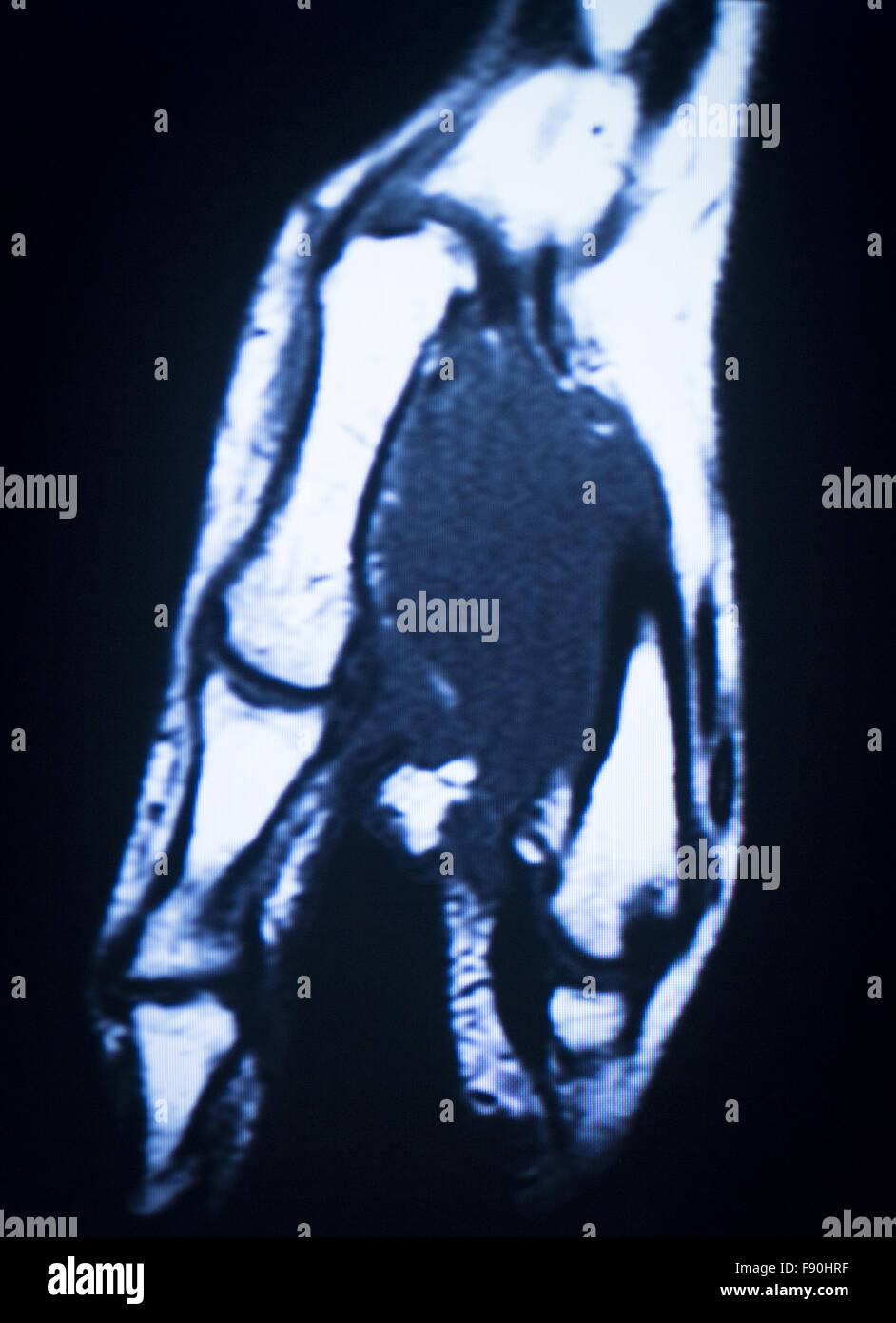 MRT Magnet-Resonanz-Tomographie medizinischen Test Scanergebnisse mit ...
