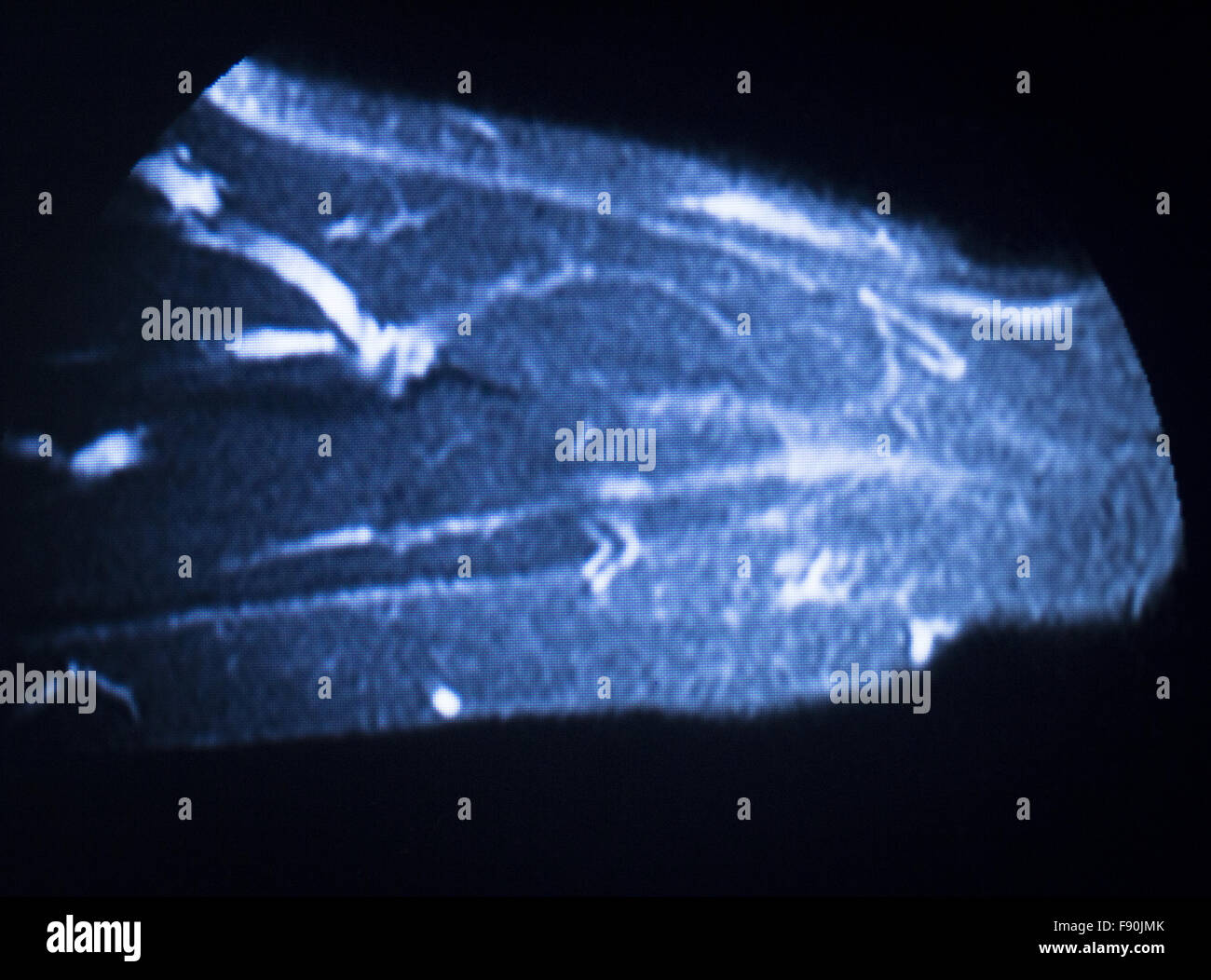 MRT Magnet-Resonanz-Tomographie medizinischen Test Scanergebnisse mit ...