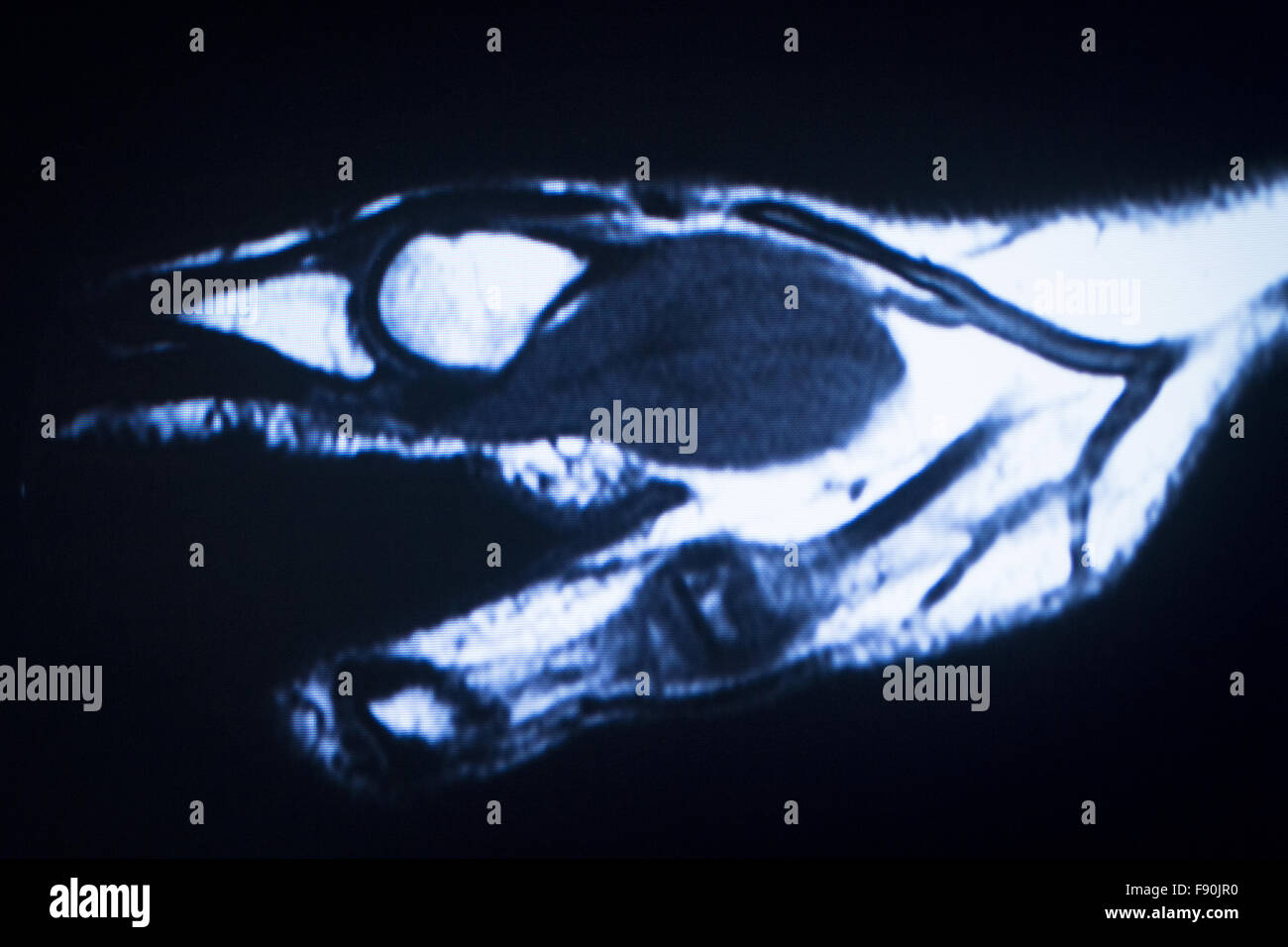MRT Magnet-Resonanz-Tomographie medizinischen Test Scanergebnisse mit ...