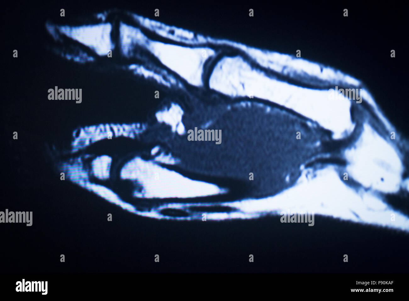 MRT Magnet-Resonanz-Tomographie medizinischen Test Scanergebnisse mit ...