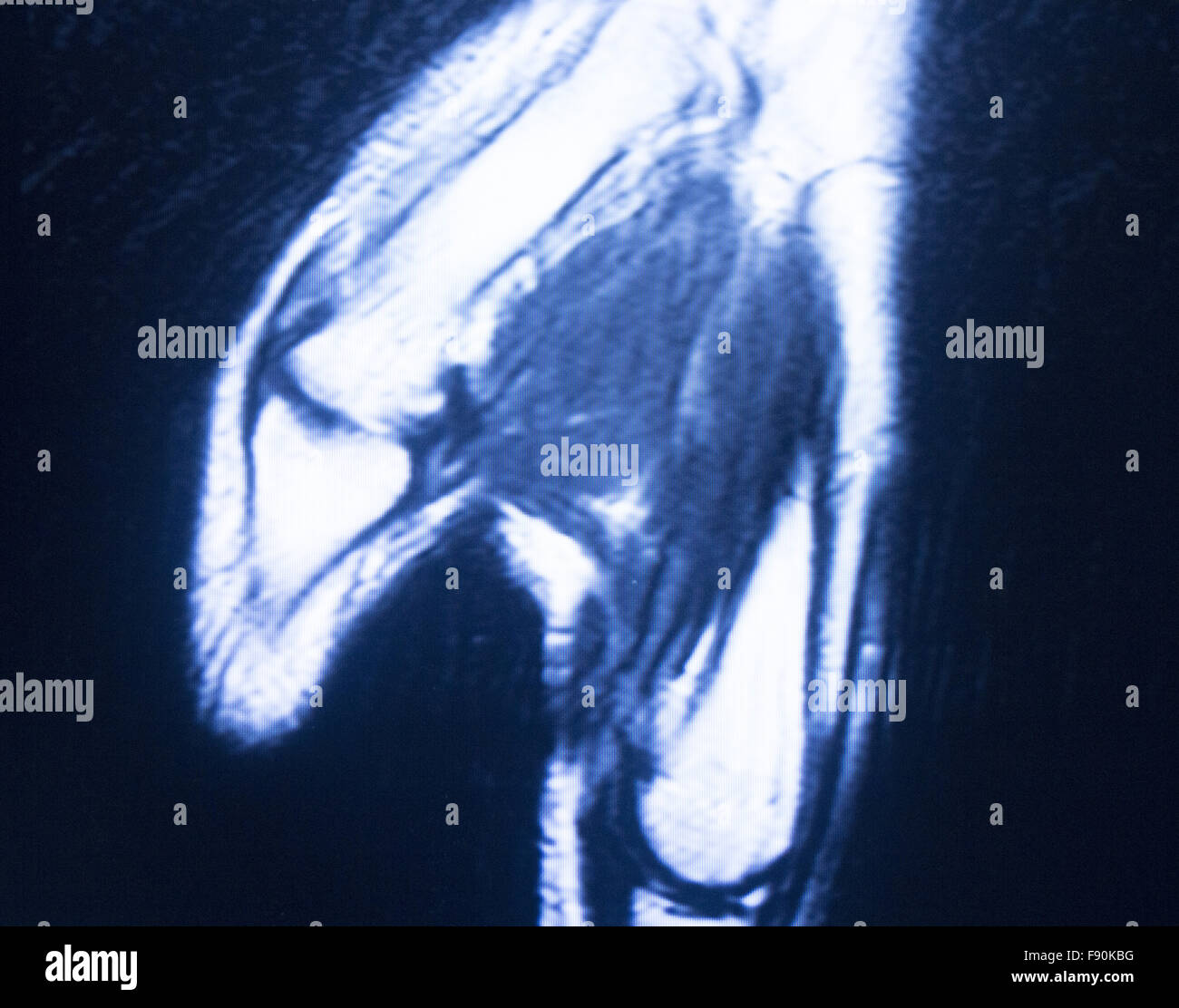 MRT Magnet-Resonanz-Tomographie medizinischen Test Scanergebnisse mit ...