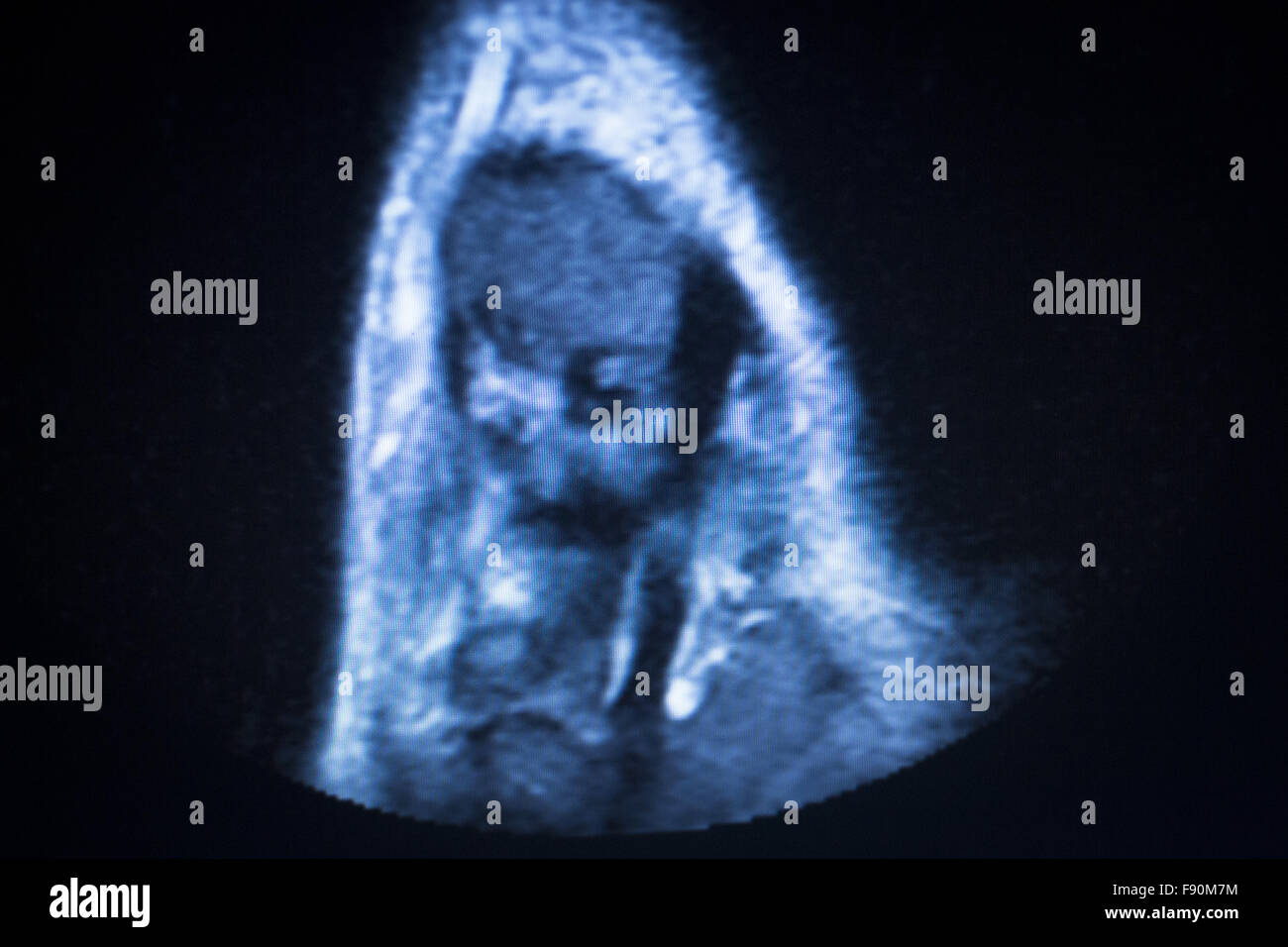 MRT Magnet-Resonanz-Tomographie medizinischen Test Scanergebnisse mit ...