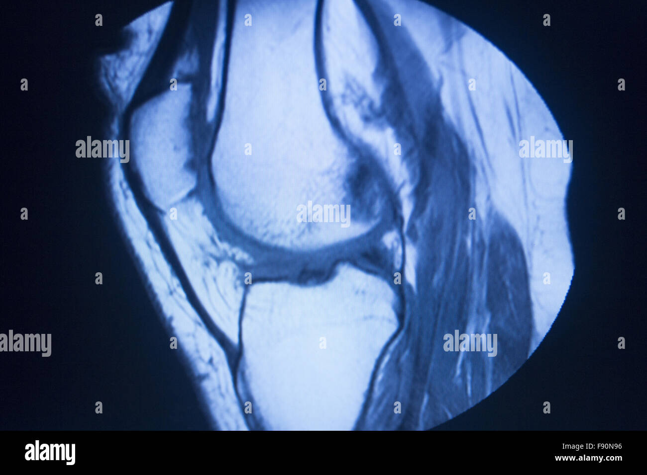MRT Magnet-Resonanz-Tomographie medizinische Scan-Test-Ergebnisse ...