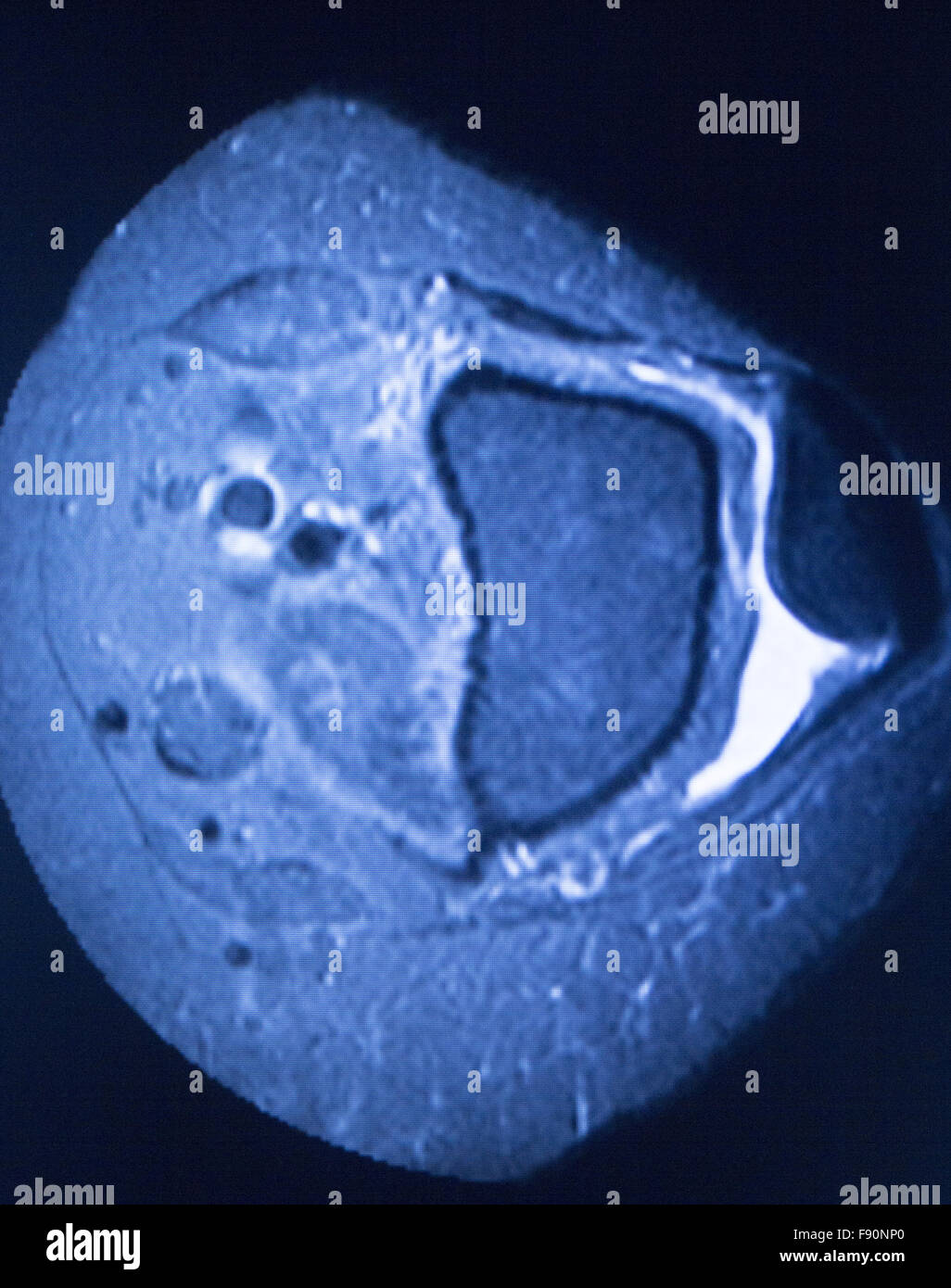 MRT Magnet-Resonanz-Tomographie medizinischen Test Scanergebnisse mit ...