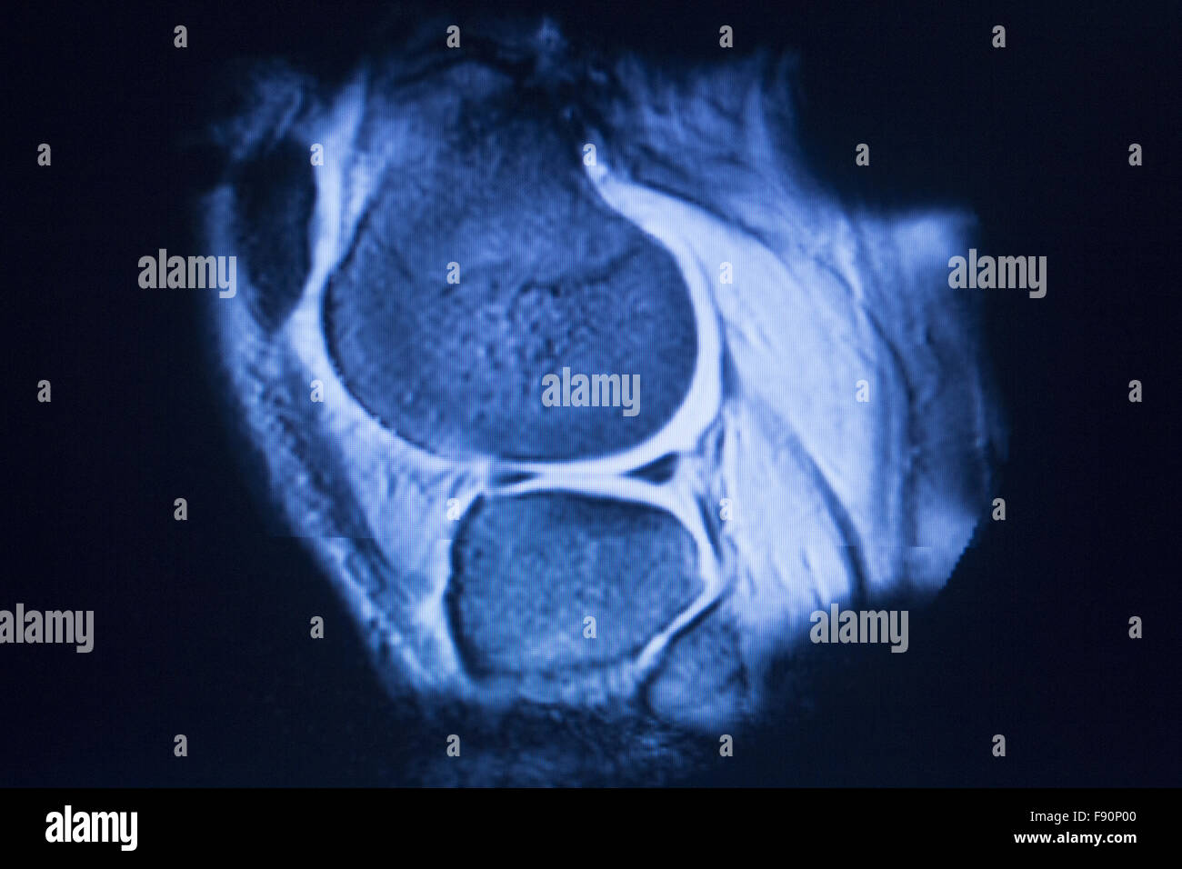 MRT Magnet-Resonanz-Tomographie medizinische Scan-Test-Ergebnisse ...