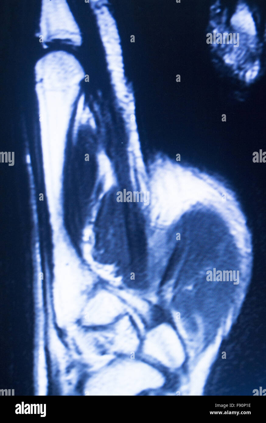 MRT Magnet-Resonanz-Tomographie medizinischen Test Scanergebnisse mit ...