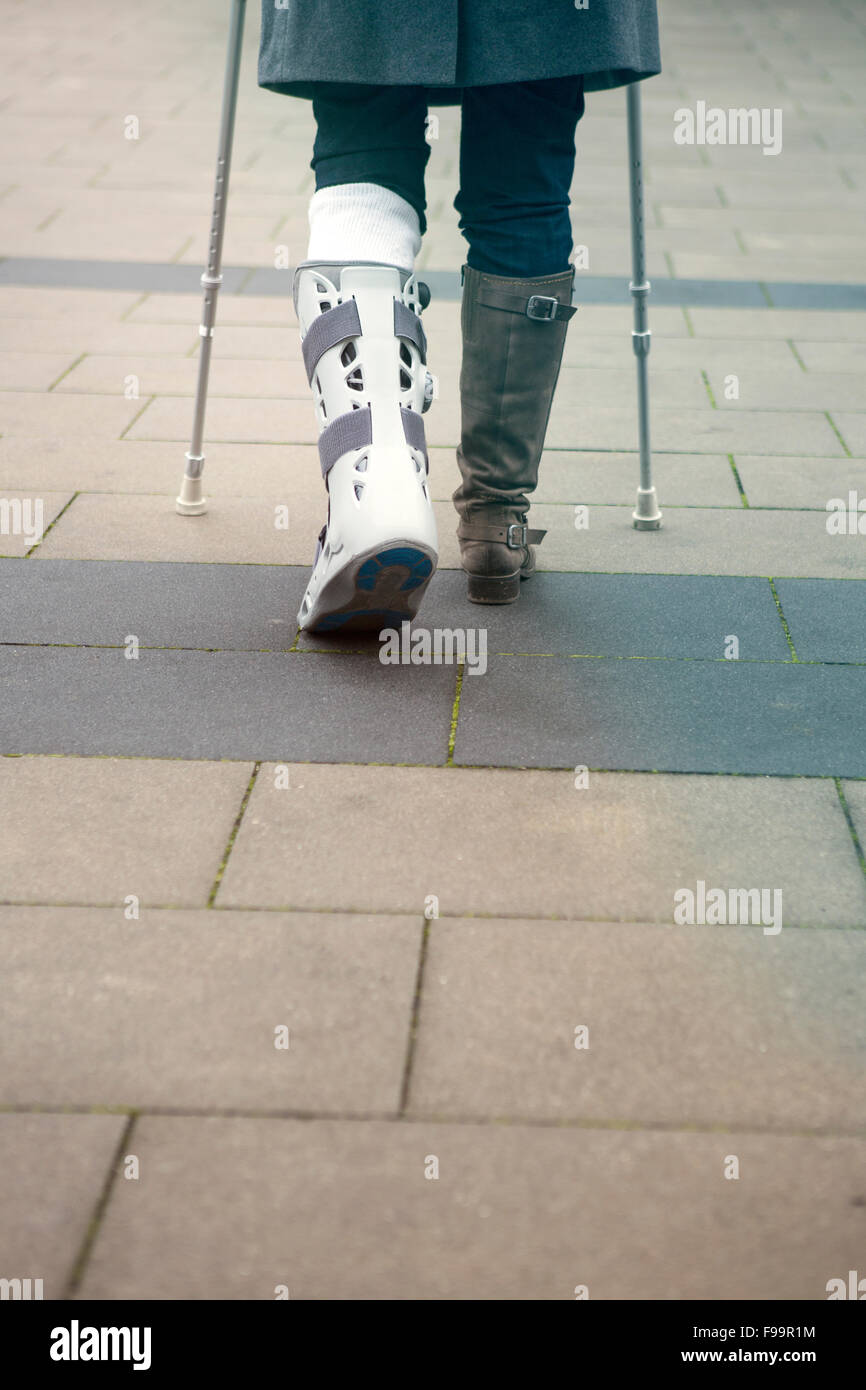 Gipsverband frau -Fotos und -Bildmaterial in hoher Auflösung – Alamy