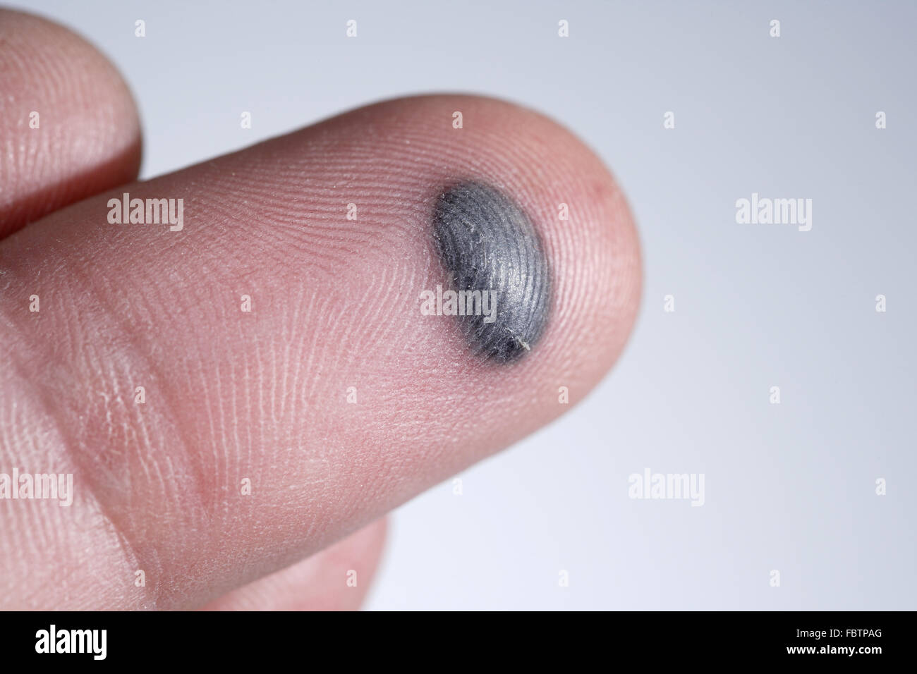 Fingerkuppe -Fotos und -Bildmaterial in hoher Auflösung – Alamy