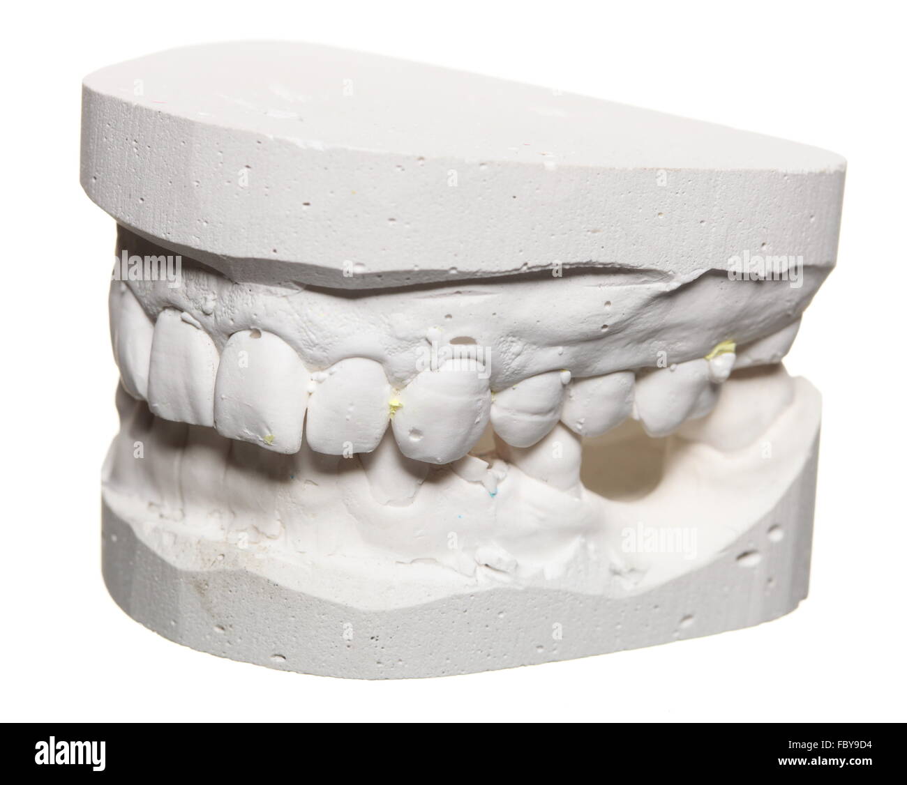 Dental Gips Modell Form der Zähne in Gips Stockfotografie - Alamy