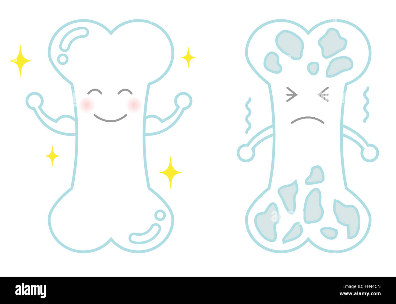 Osteoporosis bone -Fotos und -Bildmaterial in hoher Auflösung – Alamy