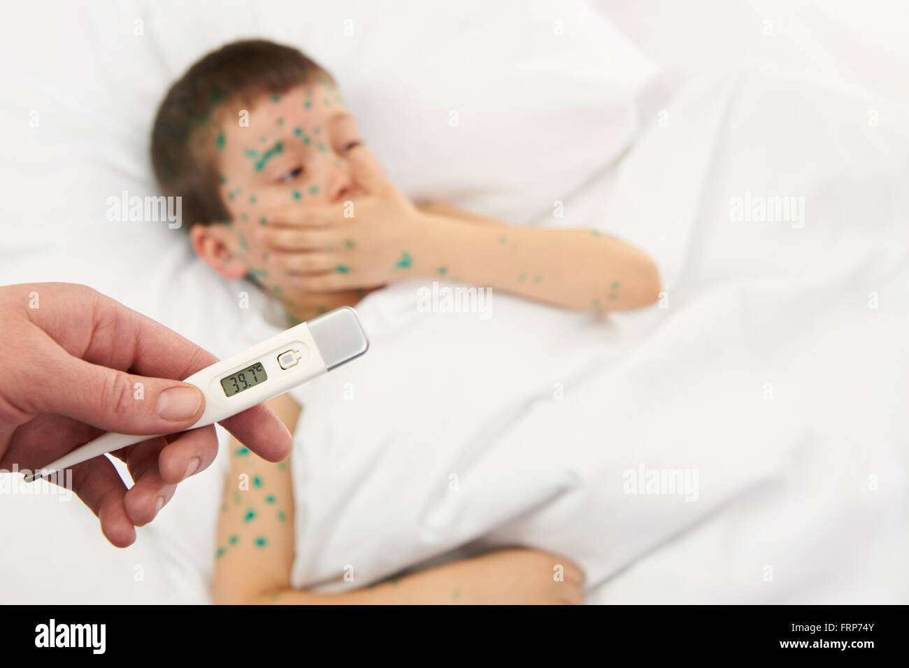 kranke Kind im Bett der Virus auf der Haut hat, die Hand der Mutter mit ...