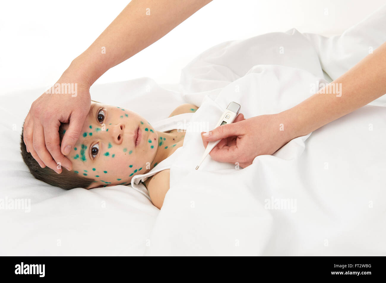 Krankes kind im bett hat das virus auf der haut -Fotos und ...