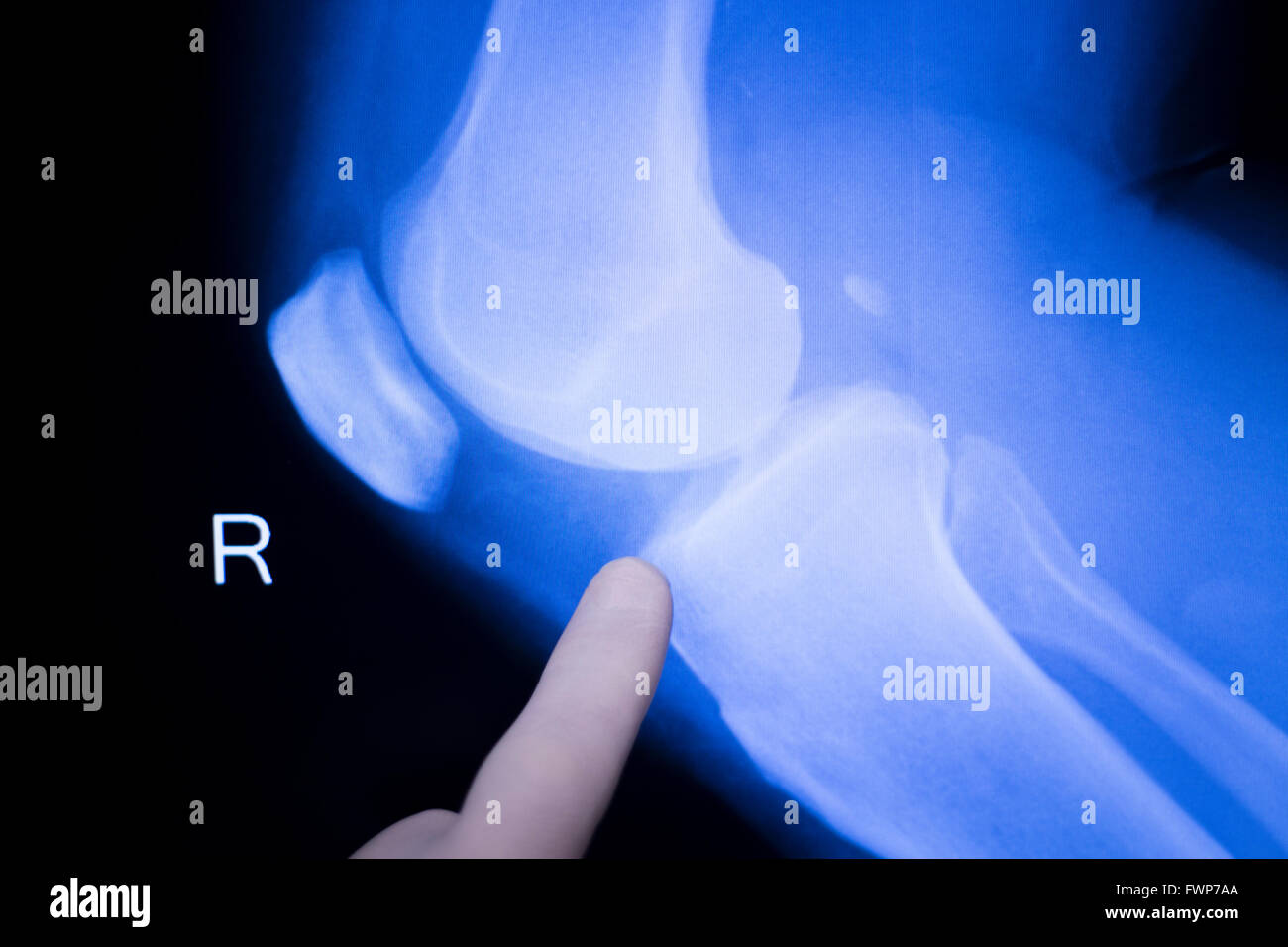 Prueba de esfuerzo de rayos x -Fotos und -Bildmaterial in hoher ...