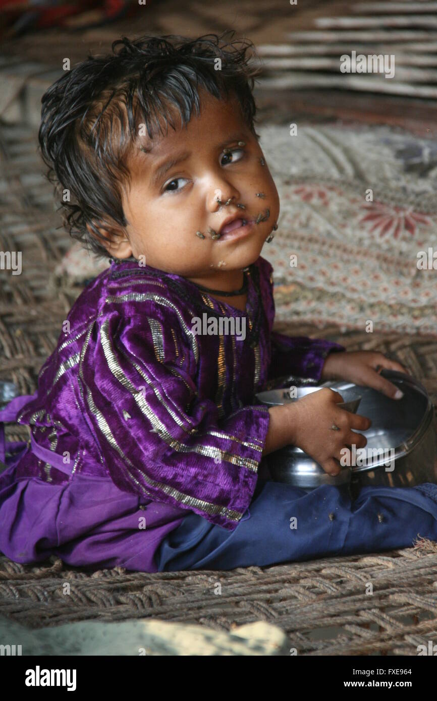 ein Portrait eines armen Babys in typischer Tracht Gesicht bedeckt ...