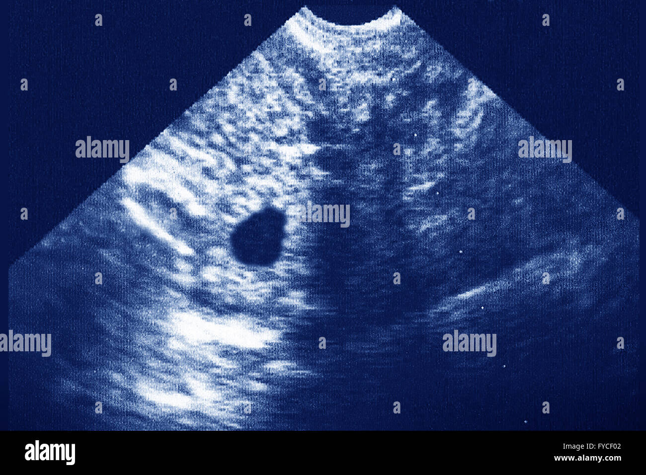 Geburtshilflichen sonogramm -Fotos und -Bildmaterial in hoher Auflösung ...