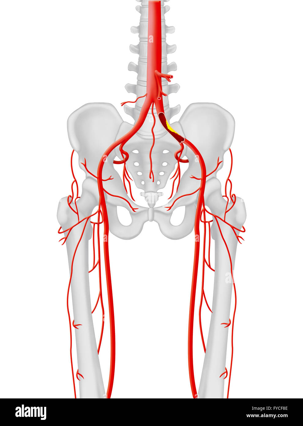 Arteria iliaca communis -Fotos und -Bildmaterial in hoher Auflösung – Alamy