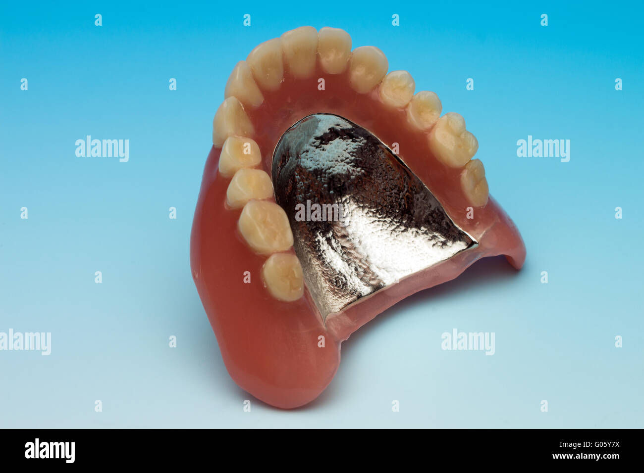 Zahnersatz Prothese mit Metallbasis Stockfotografie - Alamy
